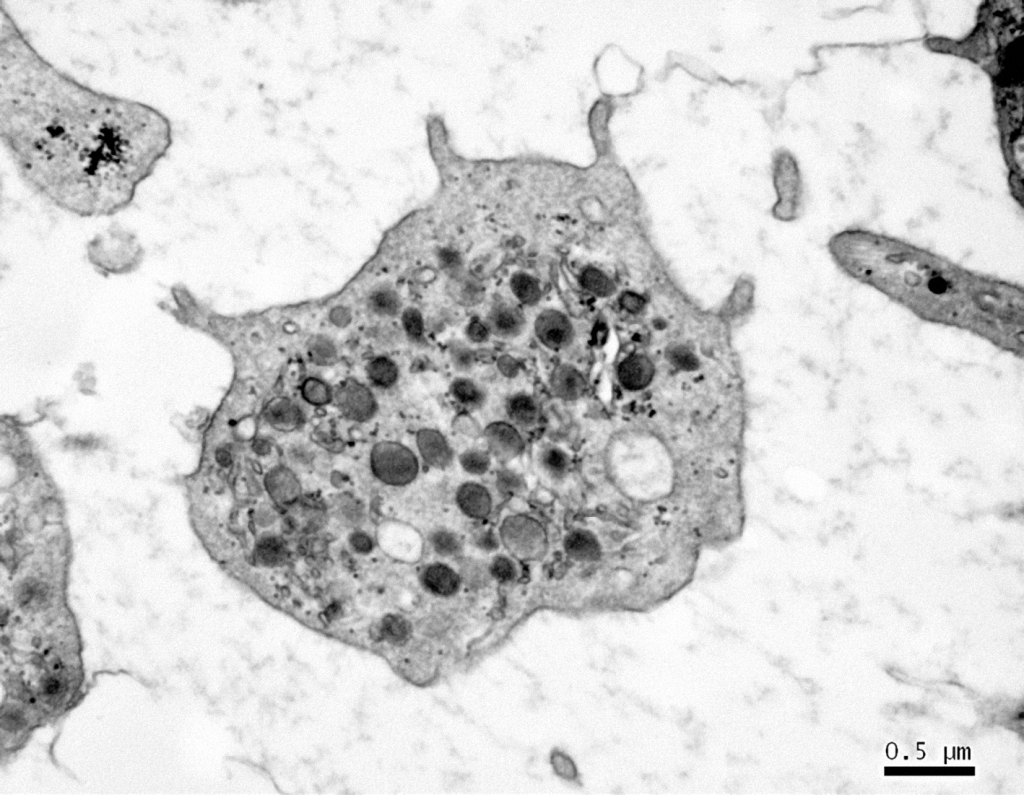Diagnosing platelet disorders - Microscopy Australia