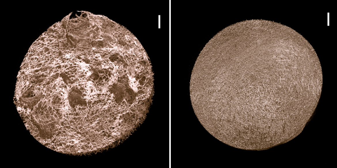 Elastagen: The future of burns is elastic - Microscopy Australia