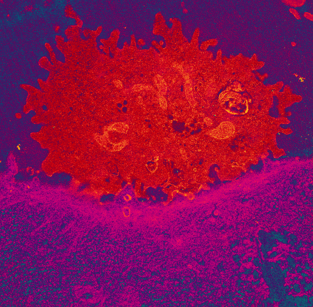 Common drug could improve cancer treatments - Microscopy Australia