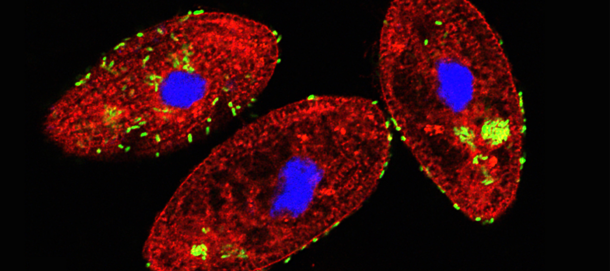 Introducing the Microbial Imaging Facility - Microscopy Australia