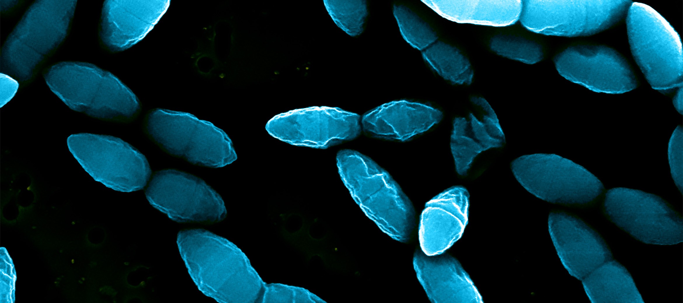 Fighting Pneumococci – the biggest bacterial killer - Microscopy Australia