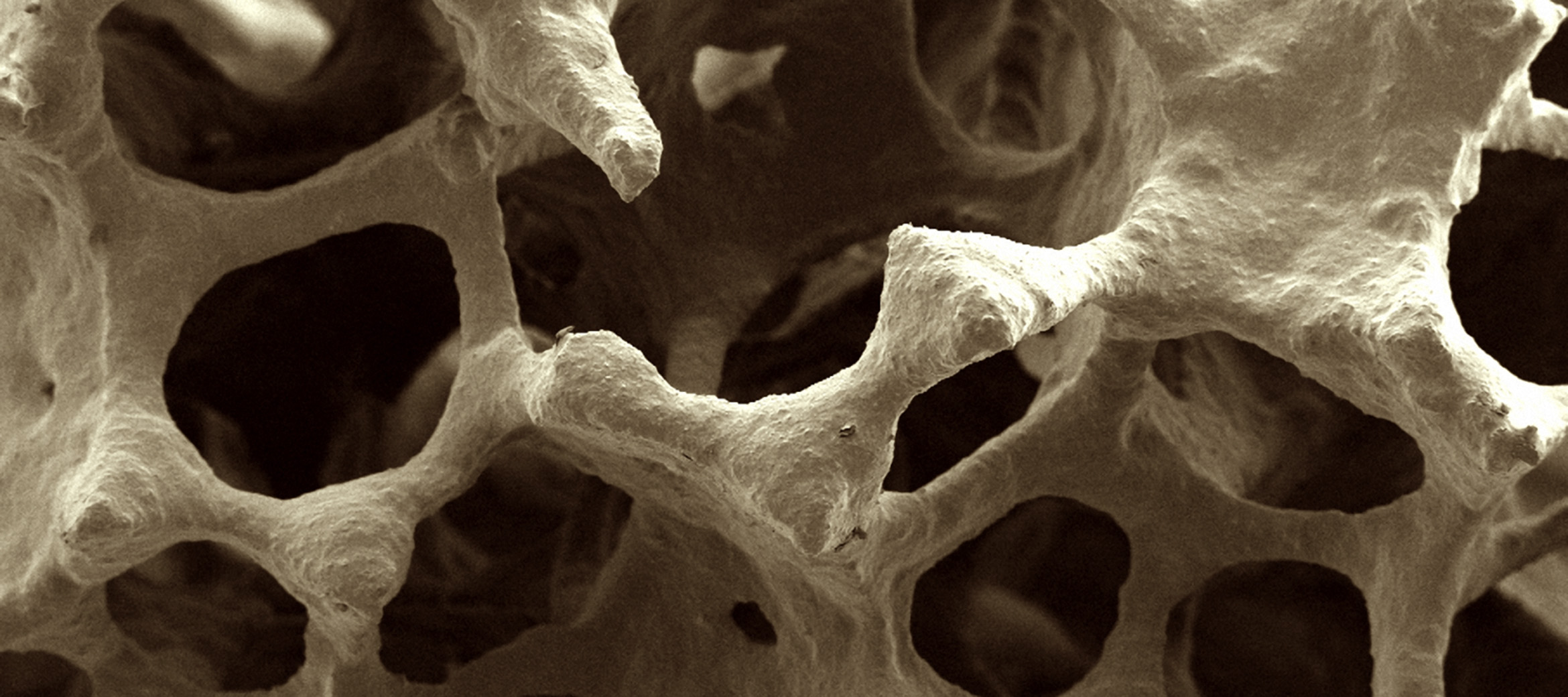 Innovation in bone replacement - Microscopy Australia