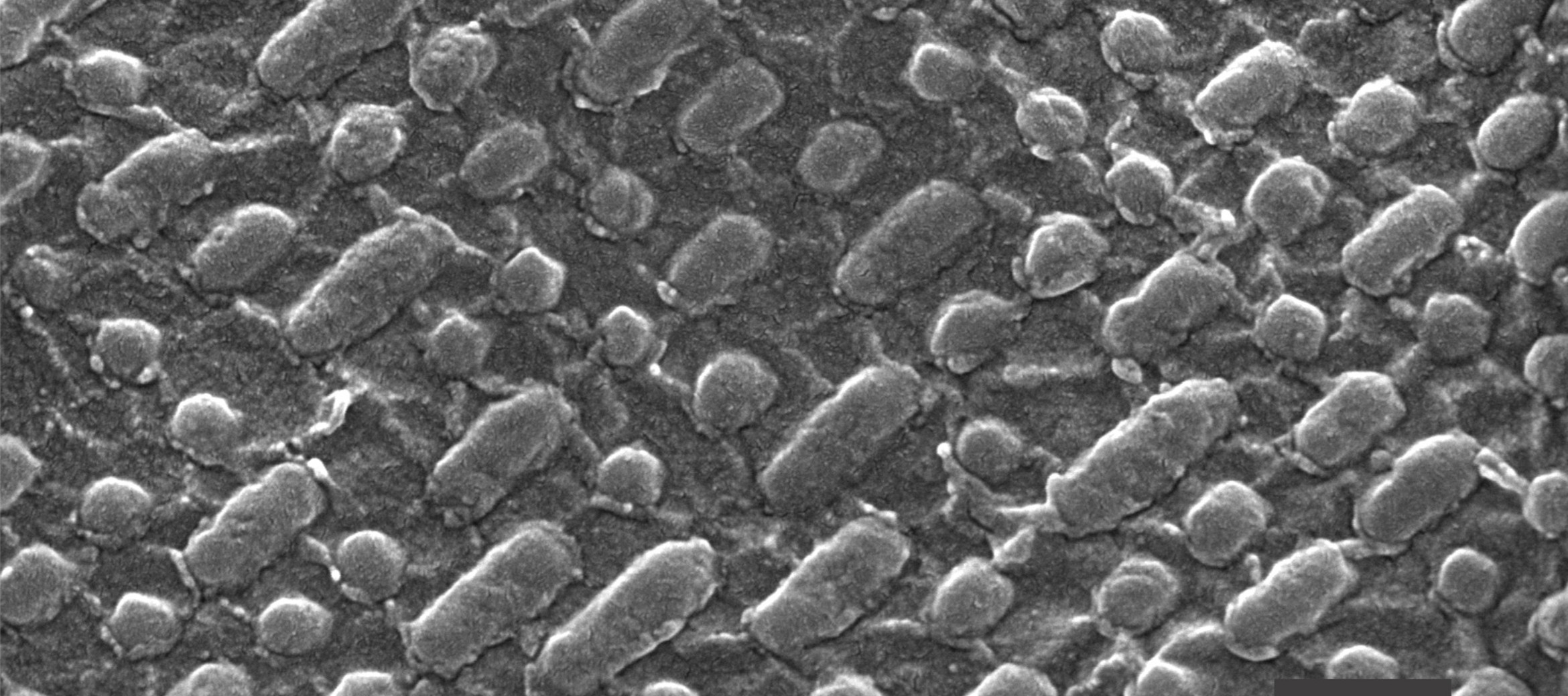 Gecko-inspired adhesive for wound repair - Microscopy Australia