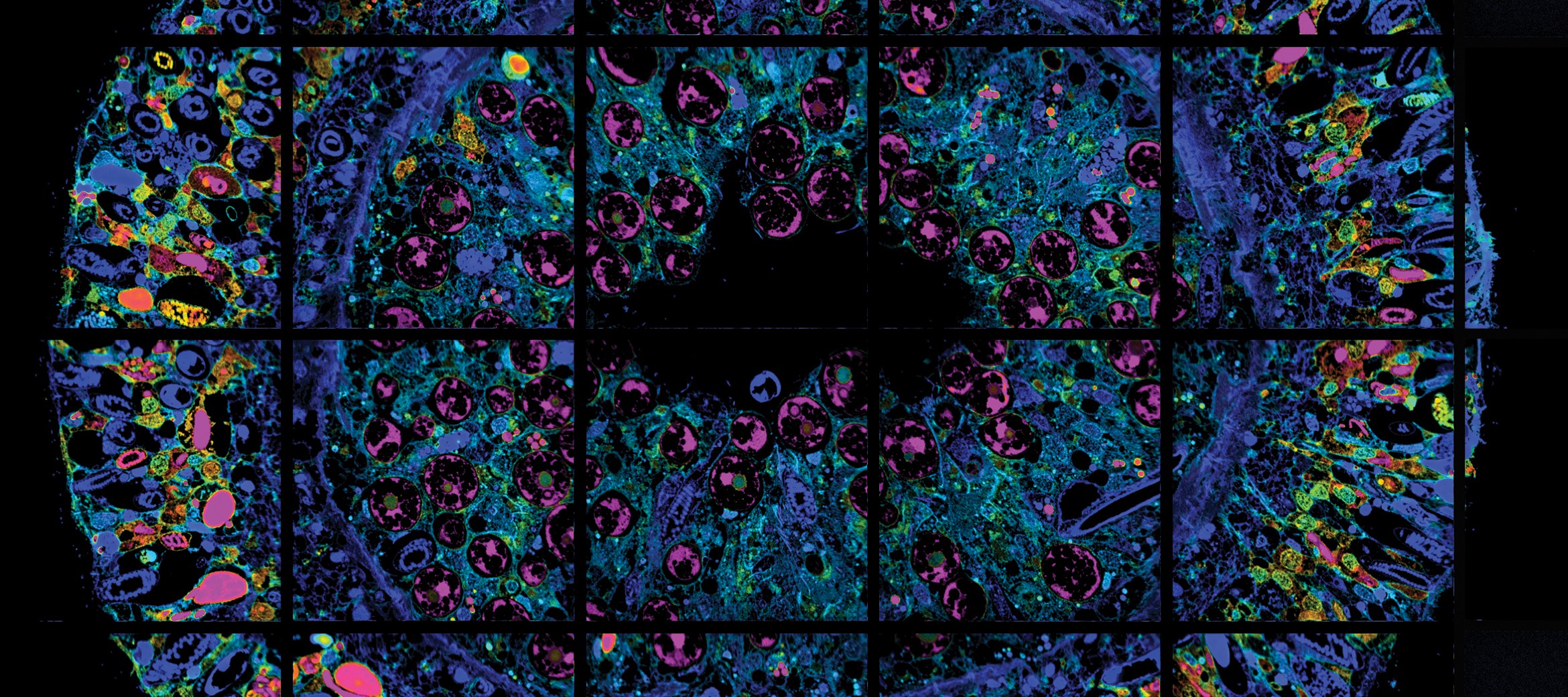 Understanding ocean health with nanoSIMS - Microscopy Australia