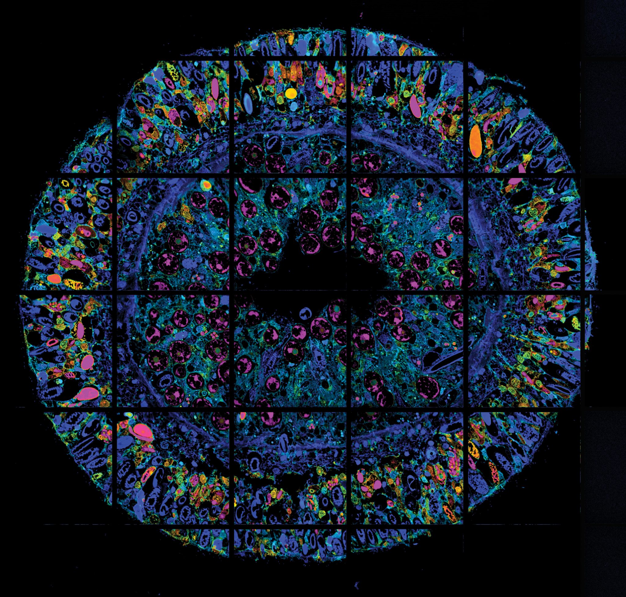 Understanding ocean health with nanoSIMS - Microscopy Australia