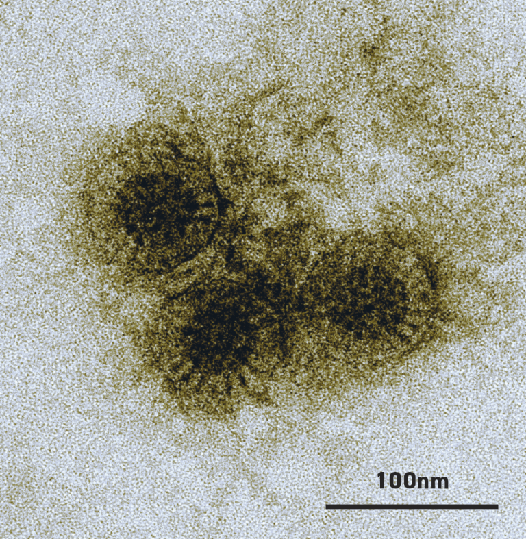 Racing to identify pigeon virus outbreak - Microscopy Australia