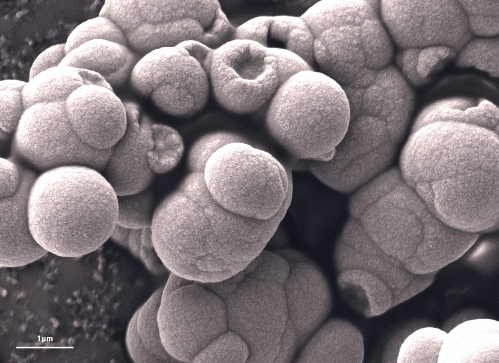 Ultra-high resolution analysis of biomarker vesicles - Microscopy Australia