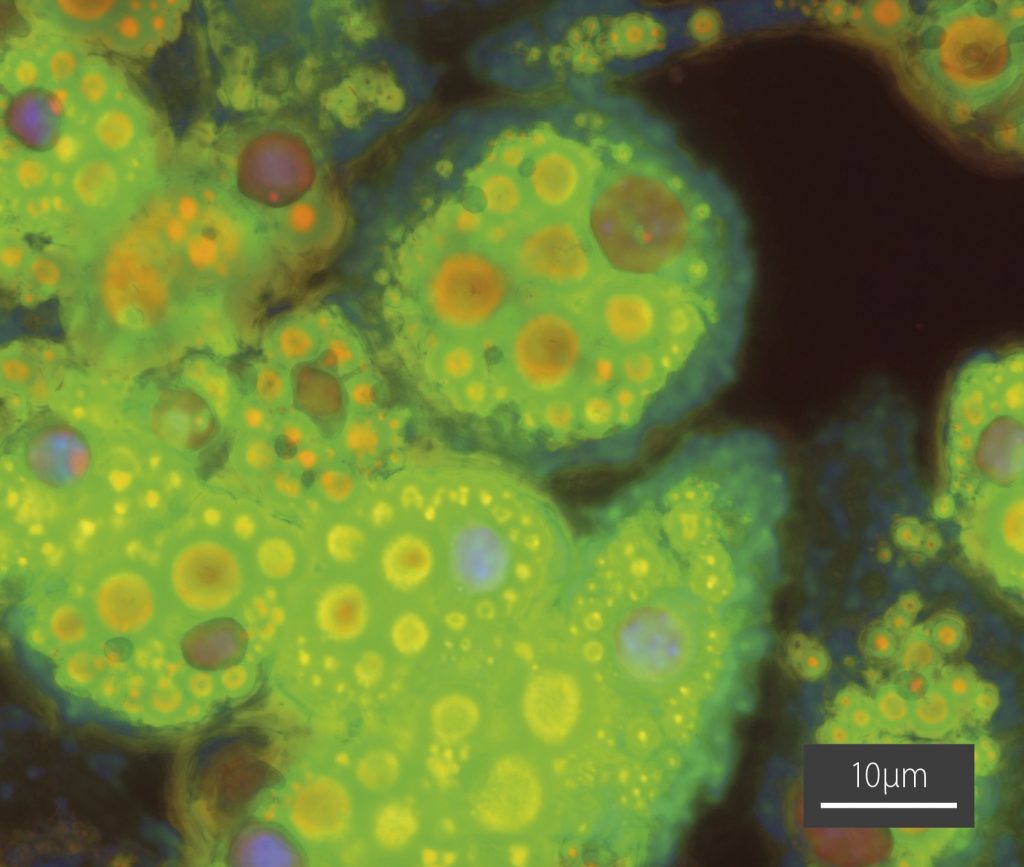 Targeting insulin resistance - Microscopy Australia