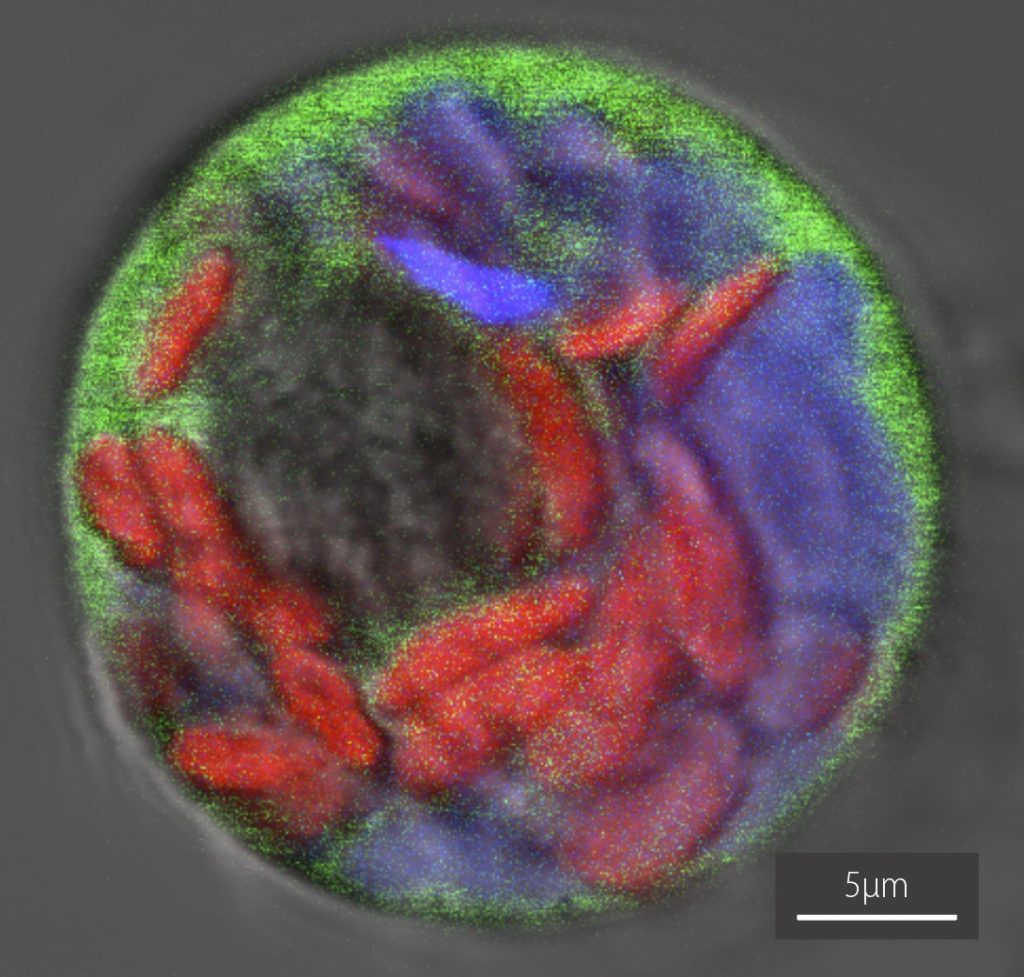 A bust for wheat rust - Microscopy Australia
