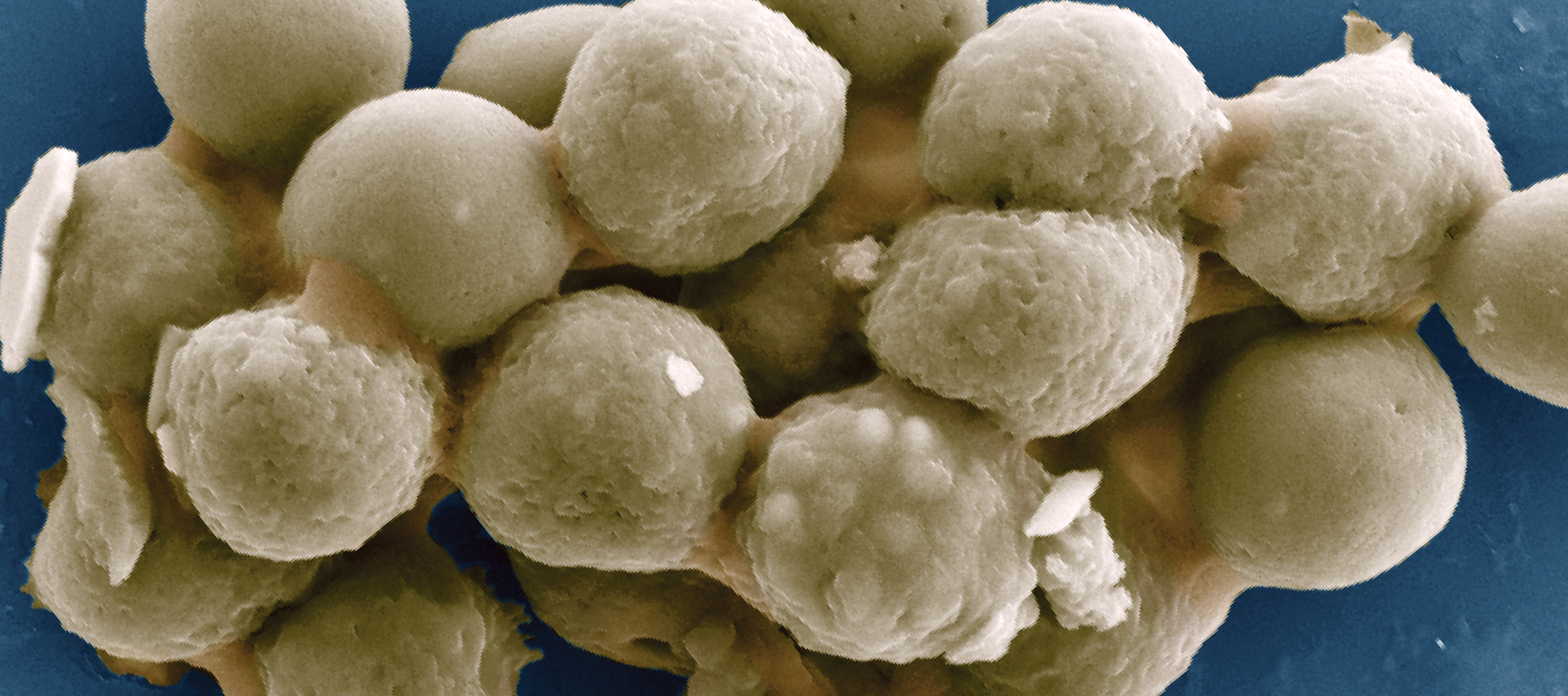 New clotting mechanism discovered - Microscopy Australia