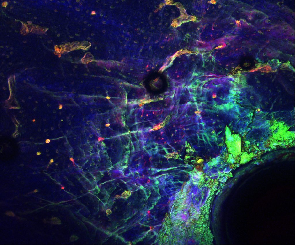 Straightening teeth without the stress - Microscopy Australia
