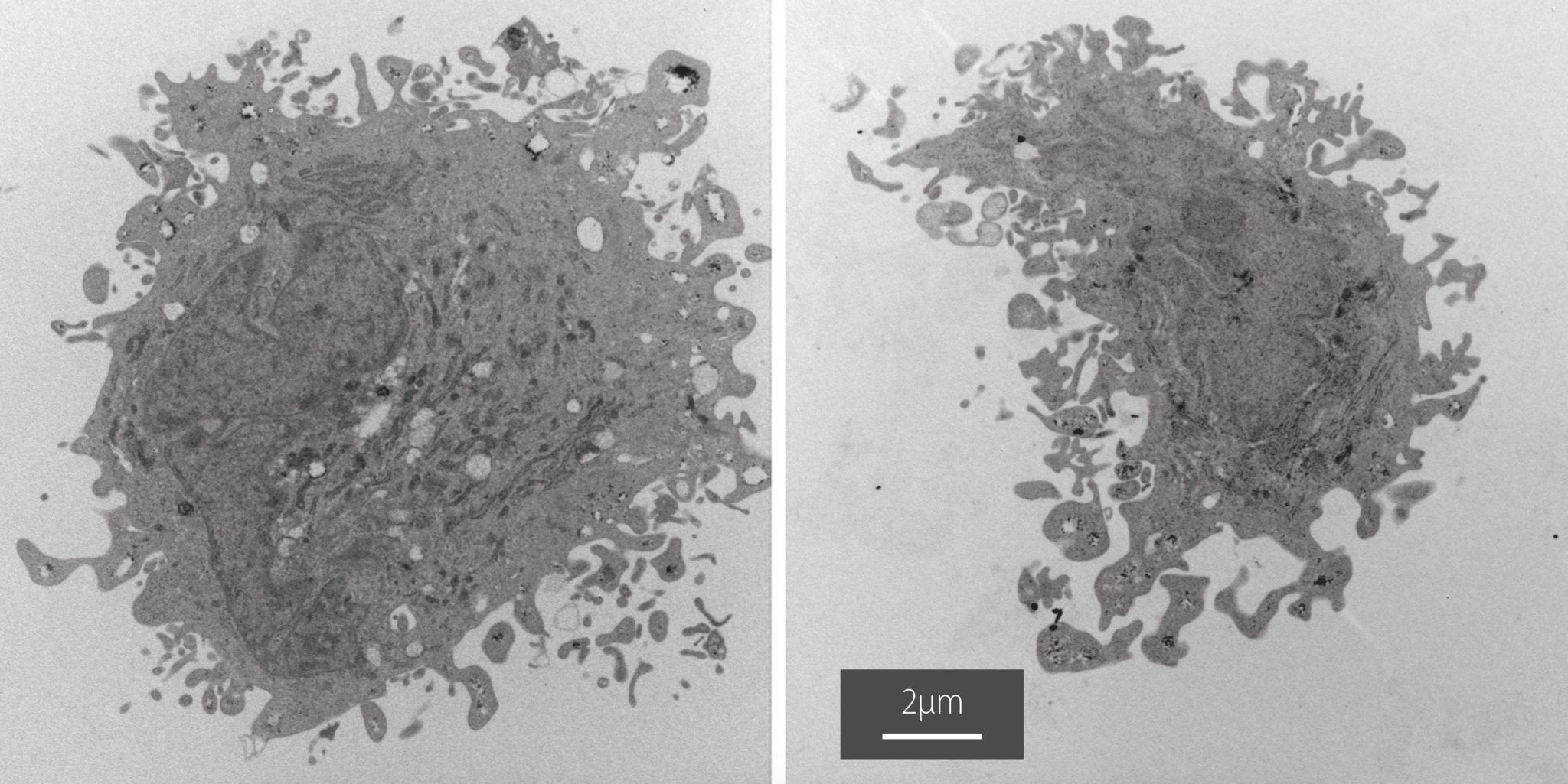 Dental pulp stem cells for treating stroke - Microscopy Australia