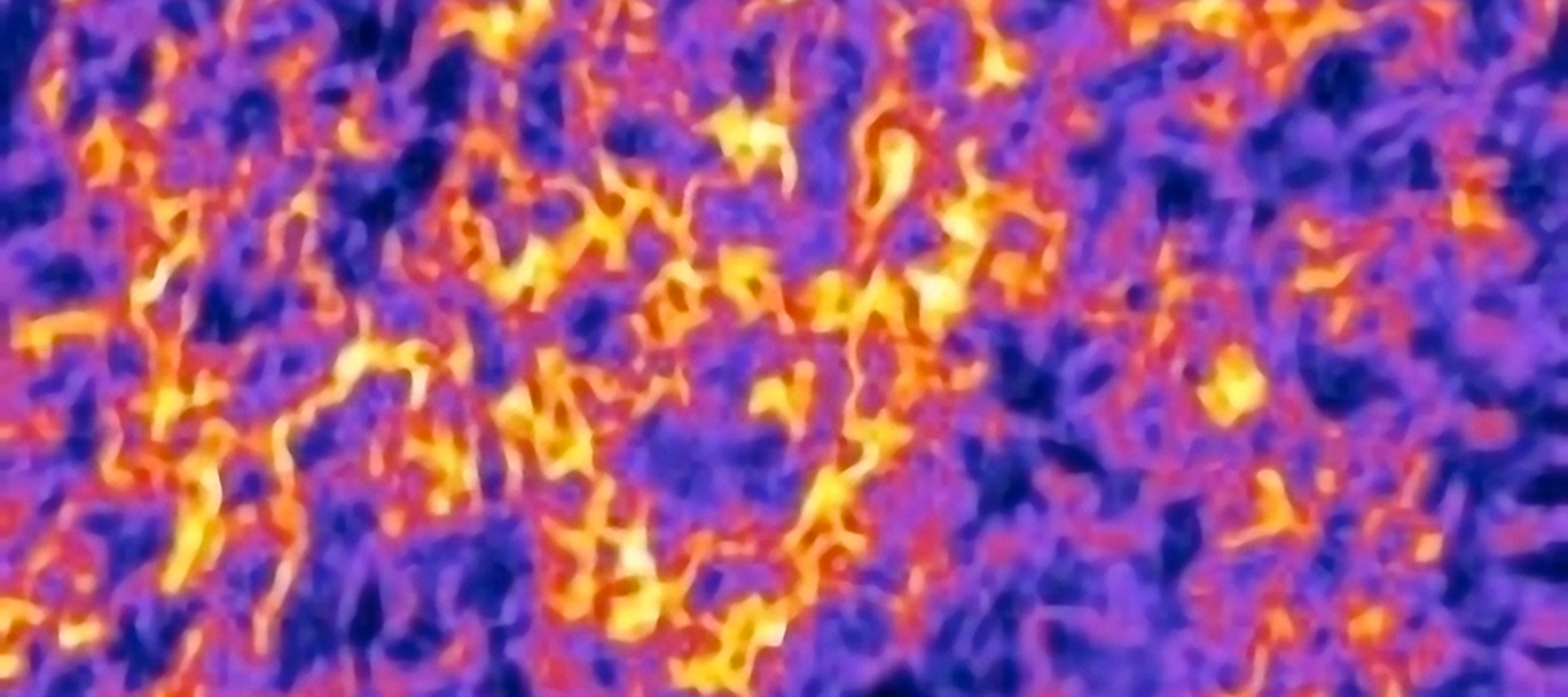 Better cholesterol imaging - Microscopy Australia