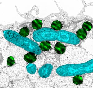 Intracellular fat droplets fighting back against bacteria - Microscopy ...