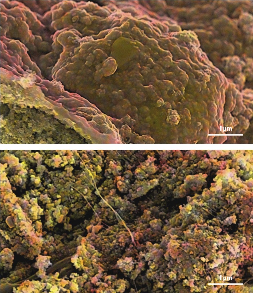 Glucose makes better batteries - Microscopy Australia