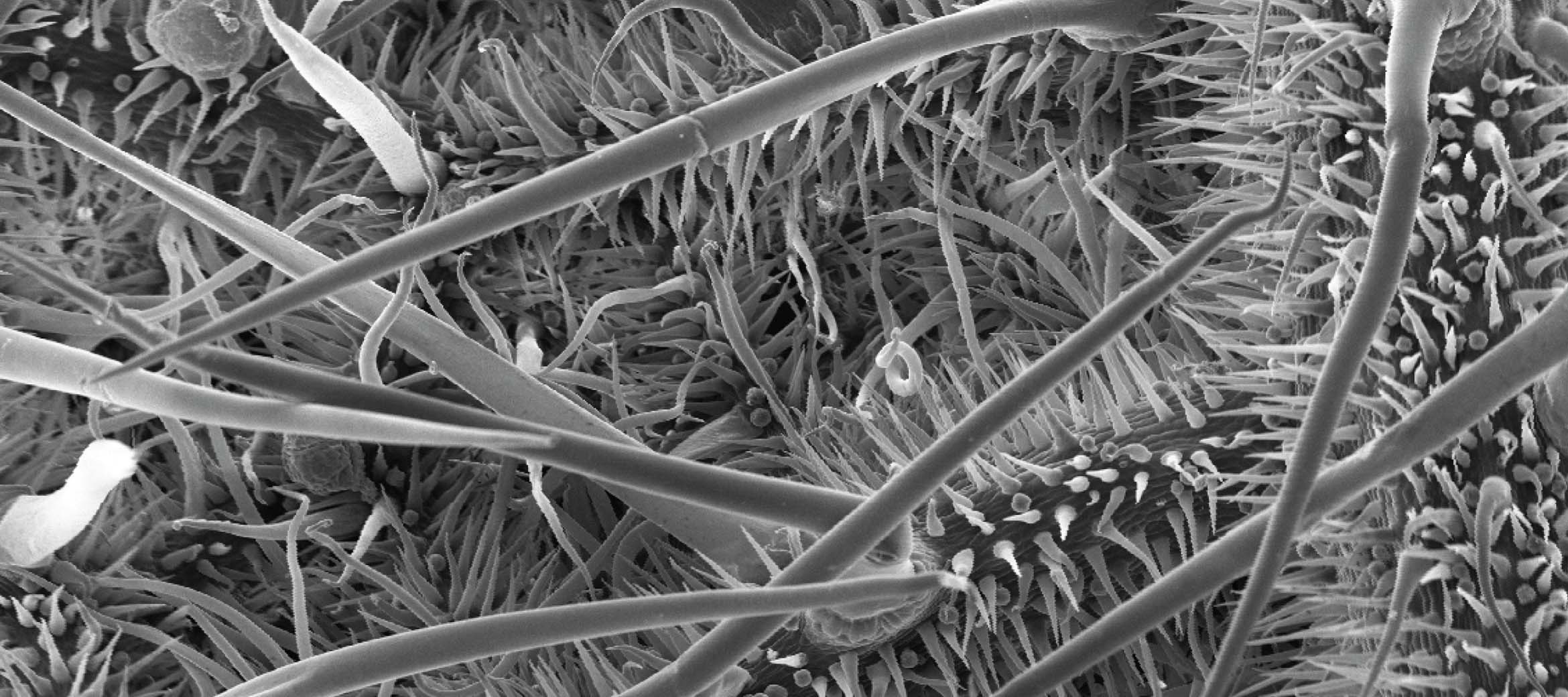 Venom to uncover pain pathways - Microscopy Australia