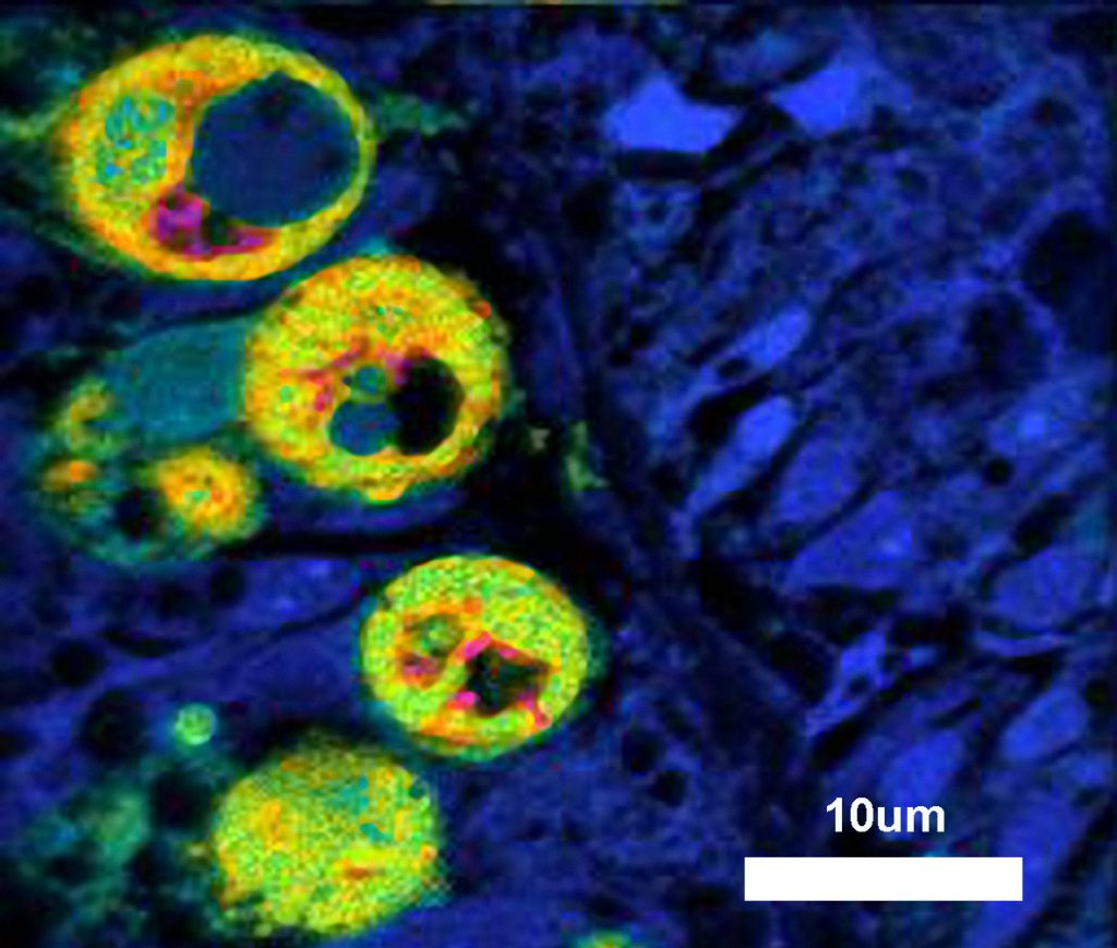 Looking deep into corals - Microscopy Australia