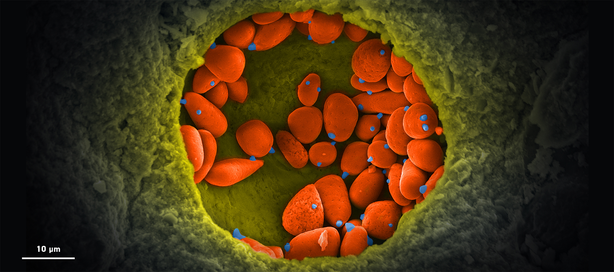 Unprecedented glimpse into 15 million year old rainforest - Microscopy ...