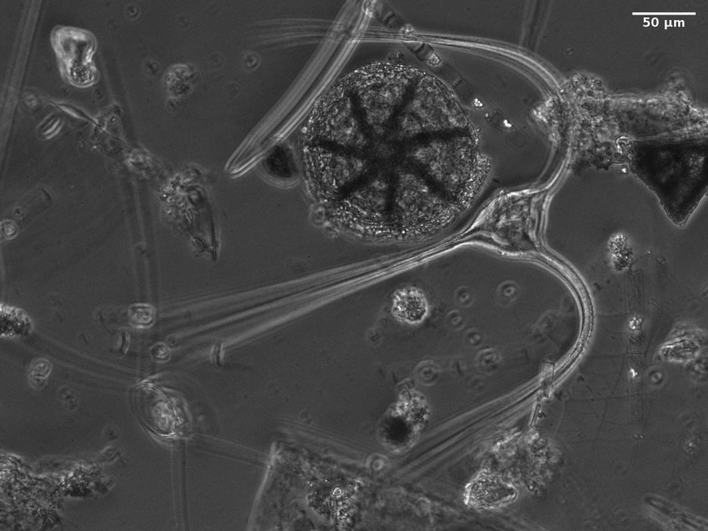 Monitoring algal blooms in a changing climate: IMOS collaboration ...