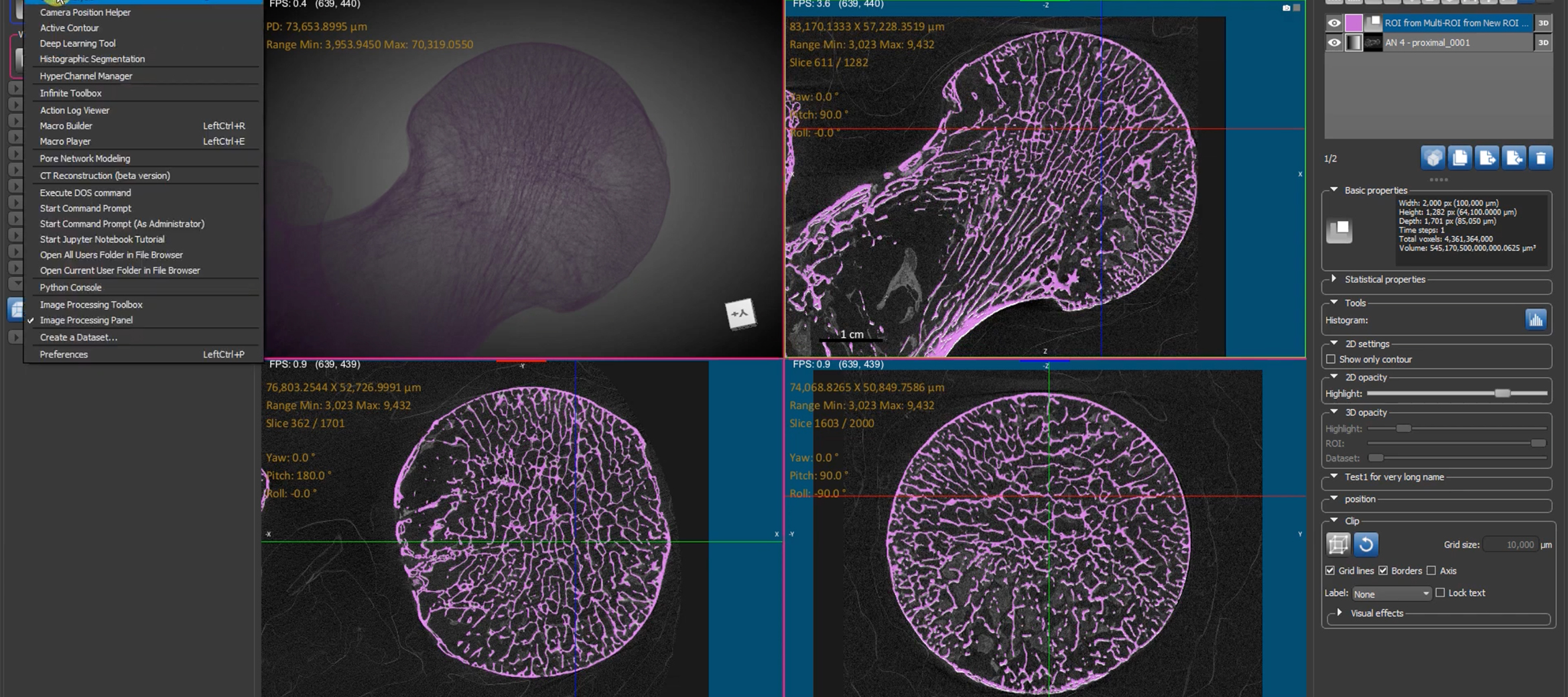 BYO Workshop: Introduction to ORS Dragonfly - Microscopy Australia