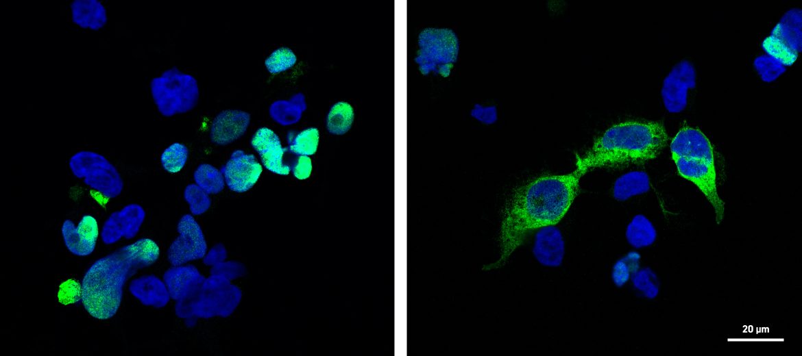 Protein discovery for better bowel cancer treatments - Microscopy Australia