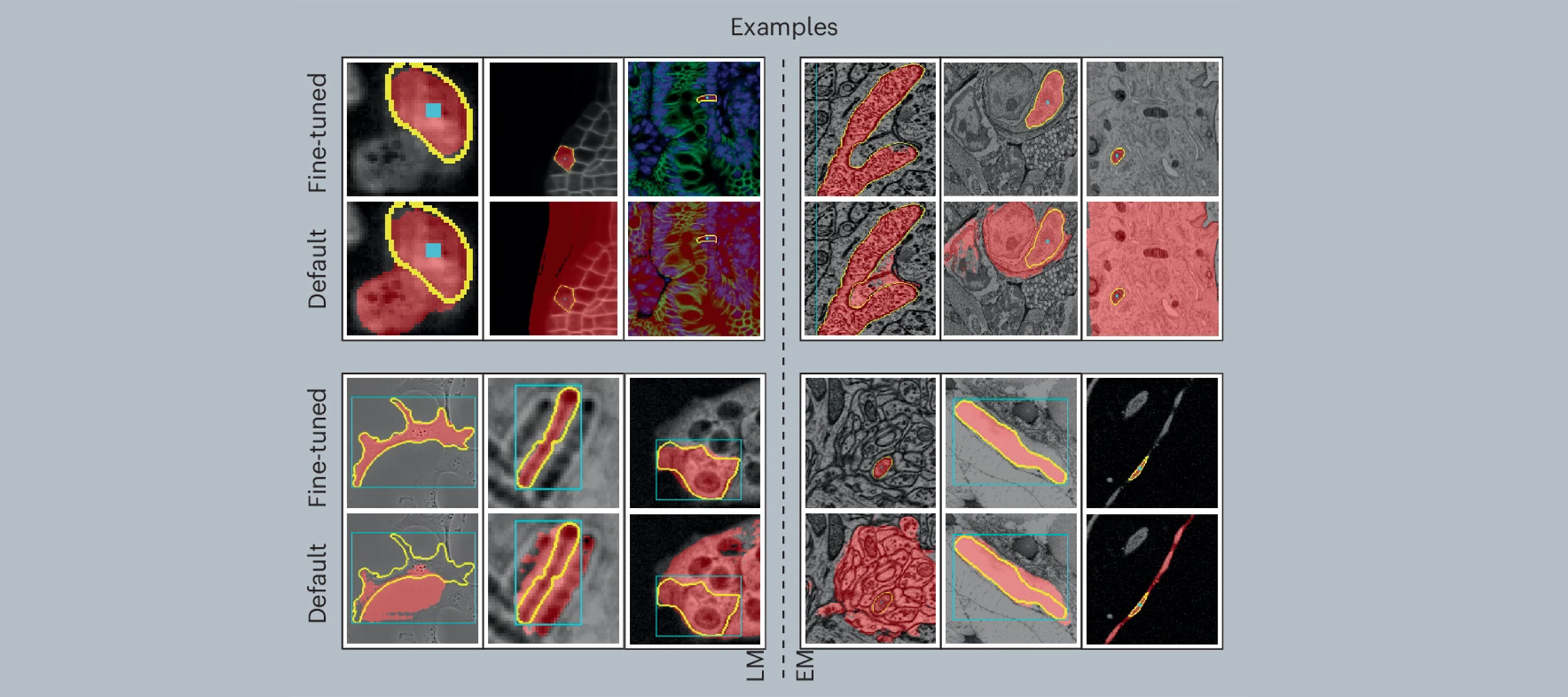 VIA Webinar: Segment Anything for Microscopy - Microscopy Australia